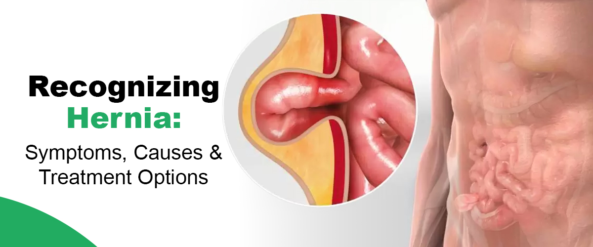 Recognizing Hernias Symptoms Causes And Treatment Options Recognizing Hernias Symptoms Causes And Treatment Options