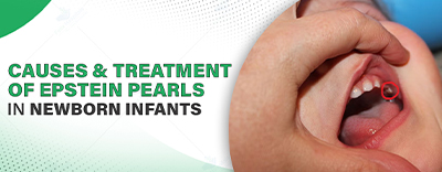 Jaundice in Newborns: Symptoms, Causes & Treatment in Noida