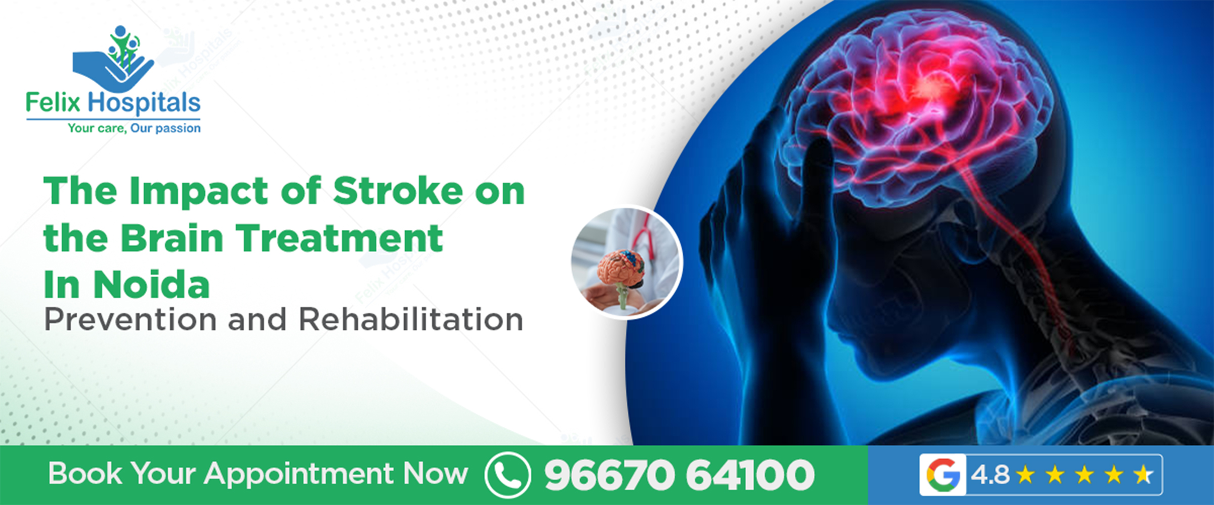 The Impact of Stroke on the Brain: Prevention and Rehabilitation
