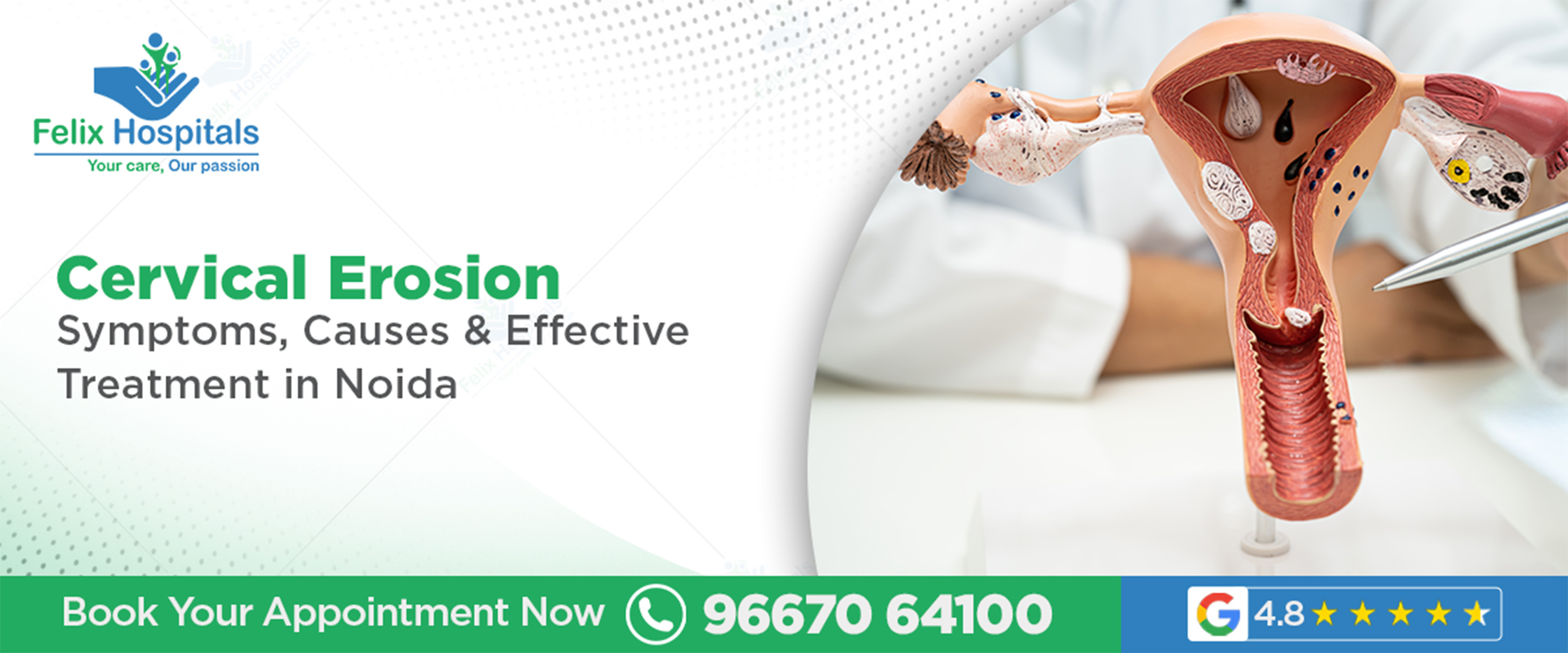 Cervical Erosion Symptoms, Causes & Effective Treatment in Noida