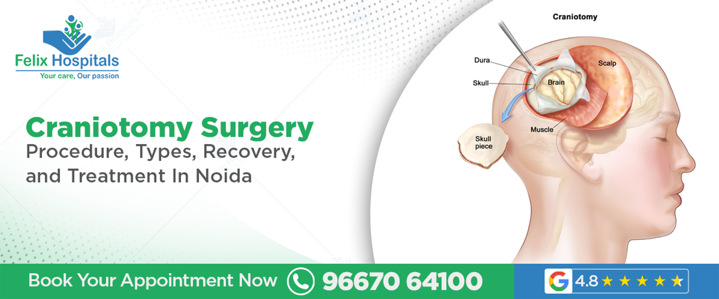 Craniotomy Surgery in India: Why Patients Worldwide Are Choosing It